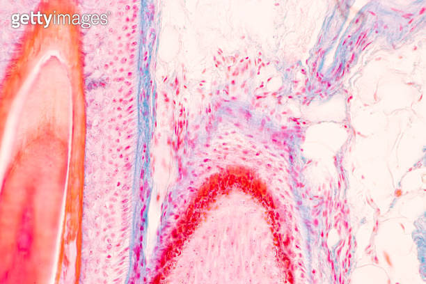 Scalp and hair follicles of human under the microscope in Lab ...