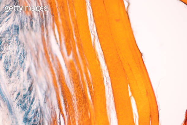 White fibrous cartilage of human under the microscope in Lab ...