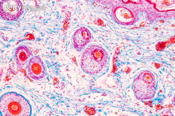 Scalp and hair follicles of human under the microscope in Lab ...