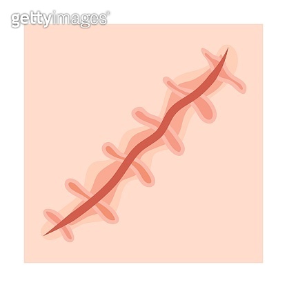 Scar cartoon illustration. Injures, scratches, bruises, surgical ...