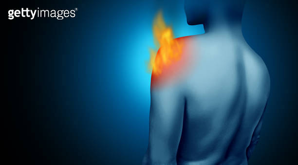 Burning Shoulder Pain 이미지 (1444062036) - 게티이미지뱅크