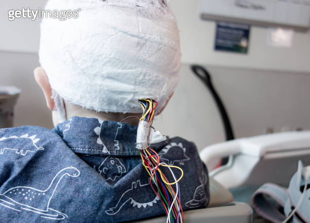 Child with Epilepsy having EEG in Hospital 이미지 (1496752410) - 게티이미지뱅크