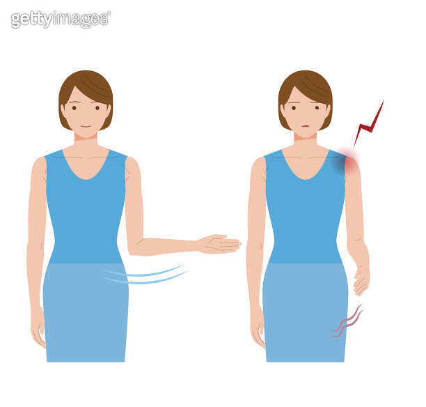 A woman whose hands cannot move behind her back due to frozen shoulders ...