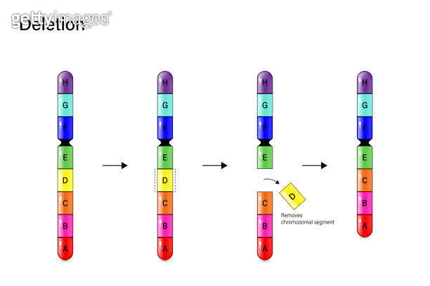 Chromosome Deletion. Genetic mutation. Alteration of chromosome ...