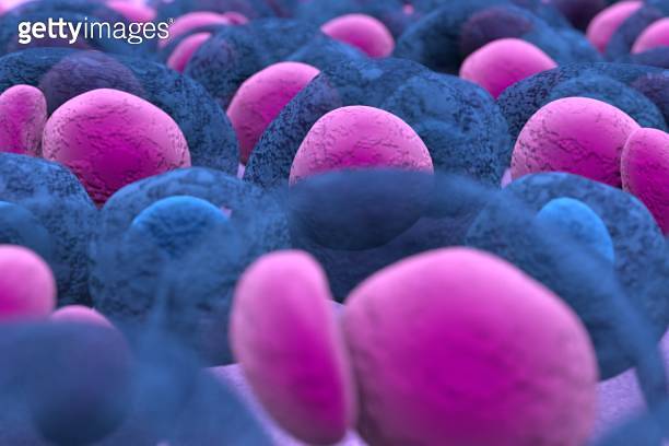 Myeloma multiplex leukemia cancer 3d color render illustration closeup ...