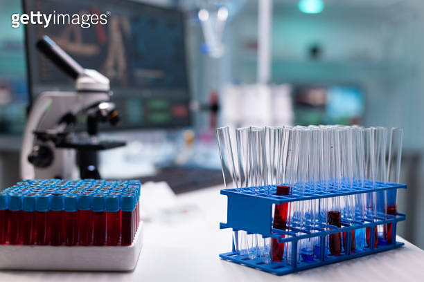 Vacutainers and test tubes on tray in science laboratory 이미지 ...