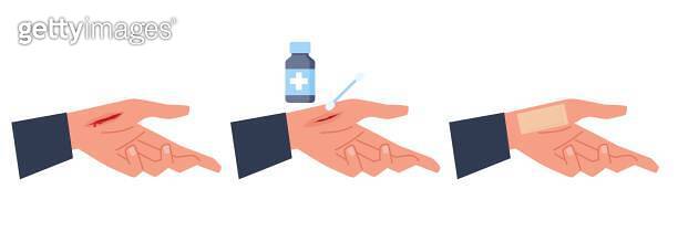 First aid for treating cut wound on hand. Treatment stages process for ...