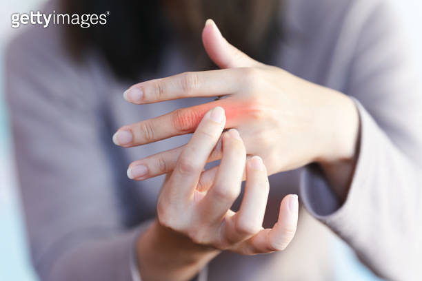 Woman has finger joint pain due to rheumatoid arthritis. Health care ...