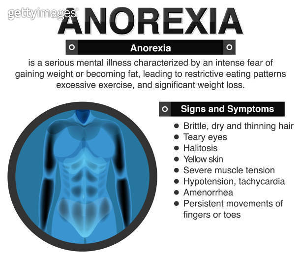 Anorexia (Anorexia) and Its Effects on the Body 이미지 (1472440132) - 게티이미지뱅크