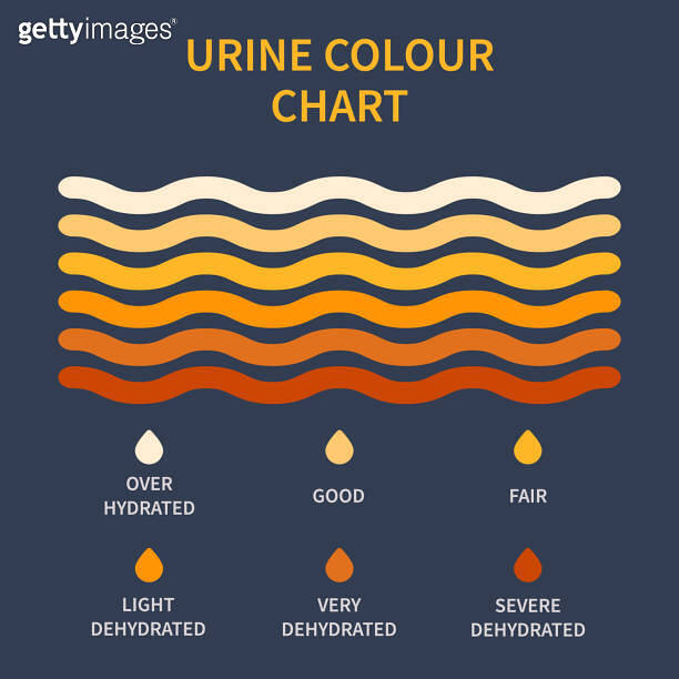 Urine color chart illustration of dehydration level 이미지 (1465580648 ...