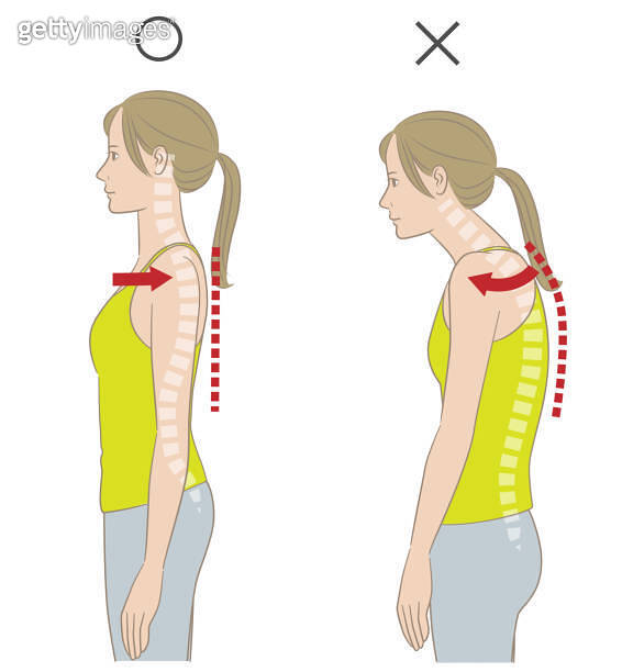 Woman with good posture and rounded shoulders (1696357070) 일러스트, 무료 ...
