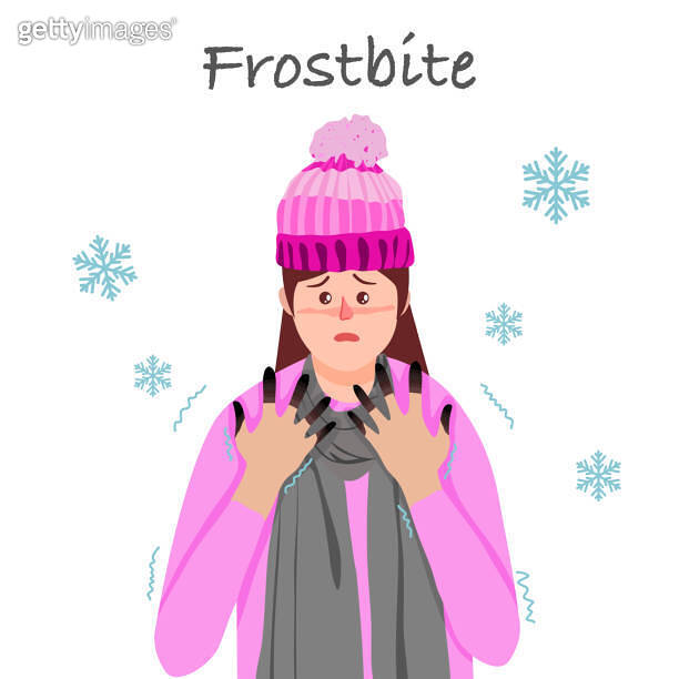 Frostbite is injury to body tissues caused by exposure to extreme cold ...
