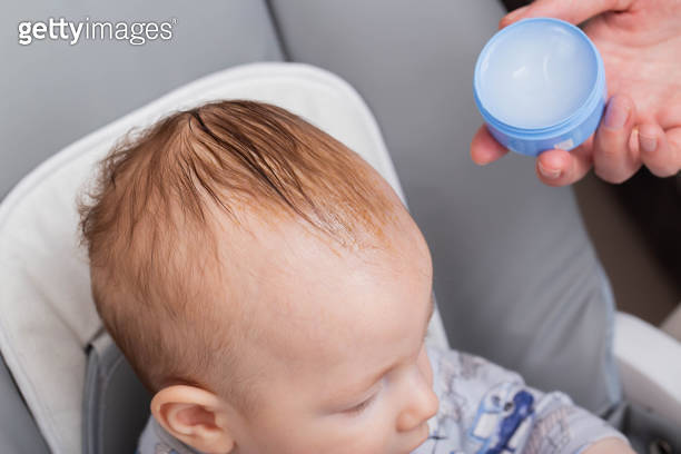 Applying a special cream and oil to the child's scalp to remove gneiss ...