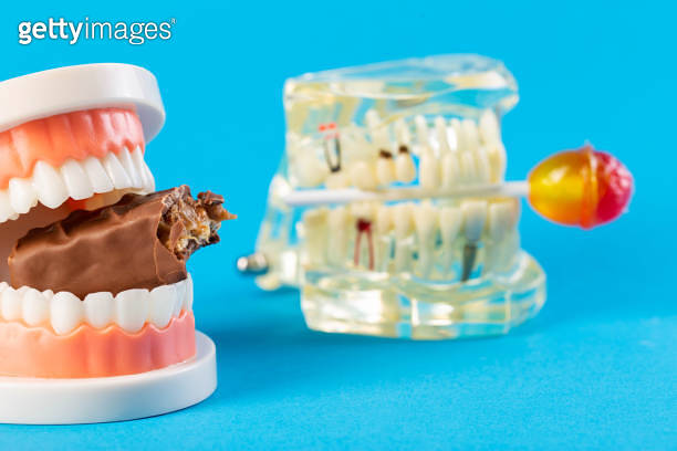 Two mock-ups of dental jaws with a lollipop and a chocolate bar on a ...