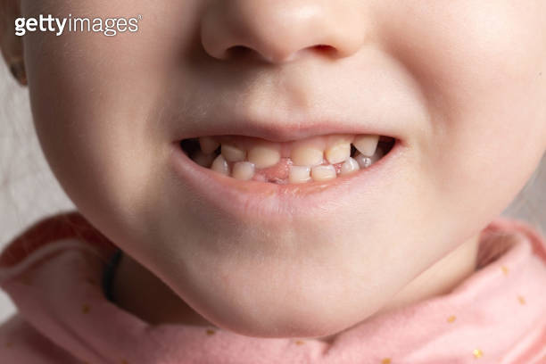 Beautiful smile of a child without one tooth. Change of milk teeth ...