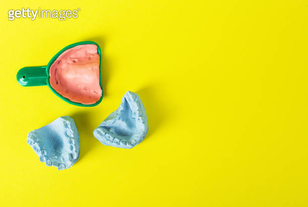 Blue plaster cast of a dental jaw and a dental tray for an impression ...