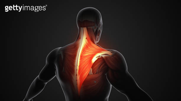 Pain and injury in the Trapezius muscles 이미지 (1732782595) - 게티이미지뱅크