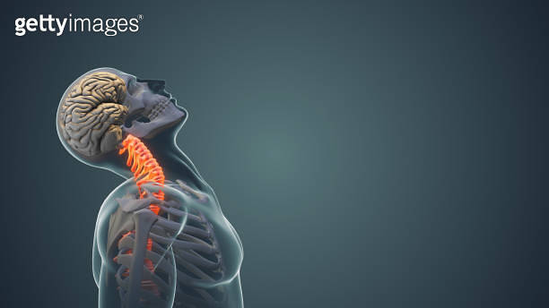 Neck pain or Cervical posture syndrome medical animation (1512637745 ...