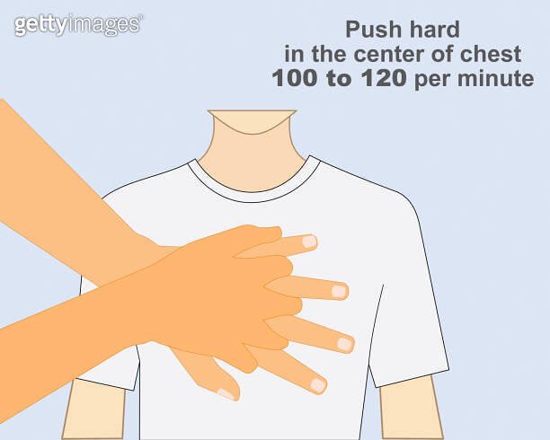 Correct hand technique for chest compression Emergency first aid CPR ...