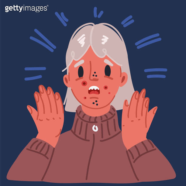 Cartoon vector illustration of Girl wih Problem face skin with acne ...