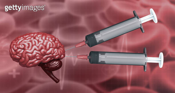 Human brain with injection syringe 이미지 (1584560070) - 게티이미지뱅크