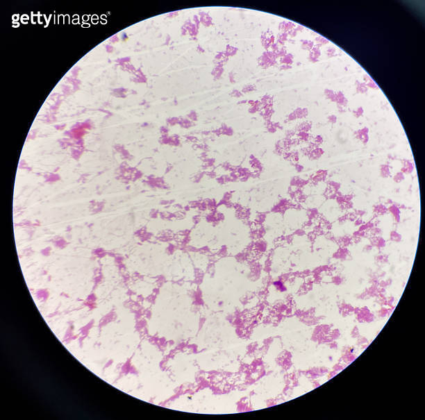 Gram negative bacilli 이미지 (1731129887) - 게티이미지뱅크