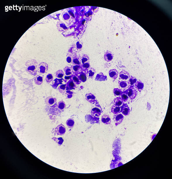 Abnormal cell 이미지 (1731130455) - 게티이미지뱅크
