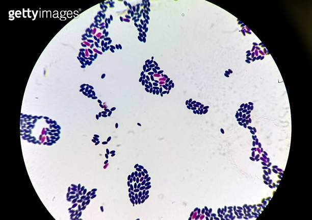 Branching budding yeast cells Candida Albican Spp. 이미지 (1758011427 ...