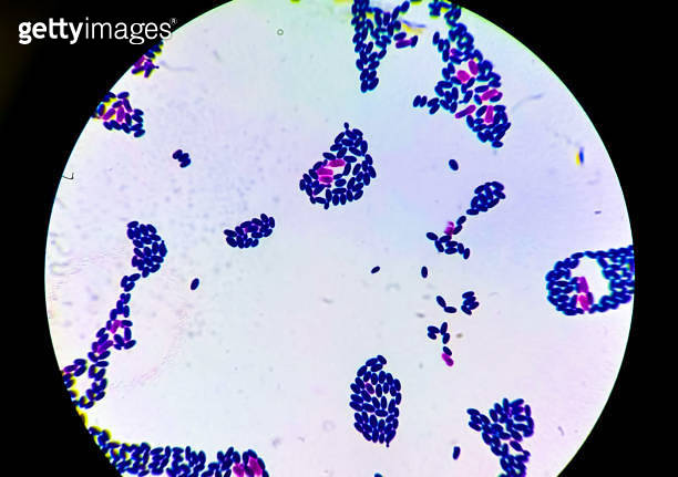 Branching budding yeast cells Candida Albican Spp. 이미지 (1758011563 ...
