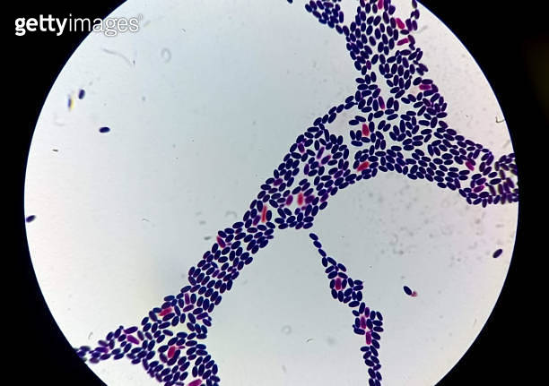 Branching budding yeast cells Candida Albican Spp. 이미지 (1758011949 ...