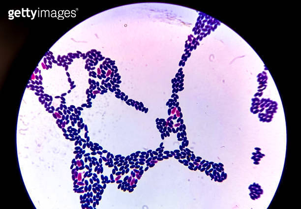 Branching budding yeast cells Candida Albican Spp. 이미지 (1758011992 ...