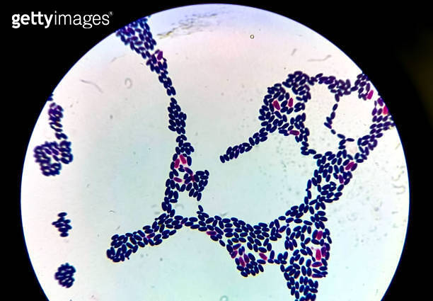 Branching budding yeast cells Candida Albican Spp. 이미지 (1758011961 ...