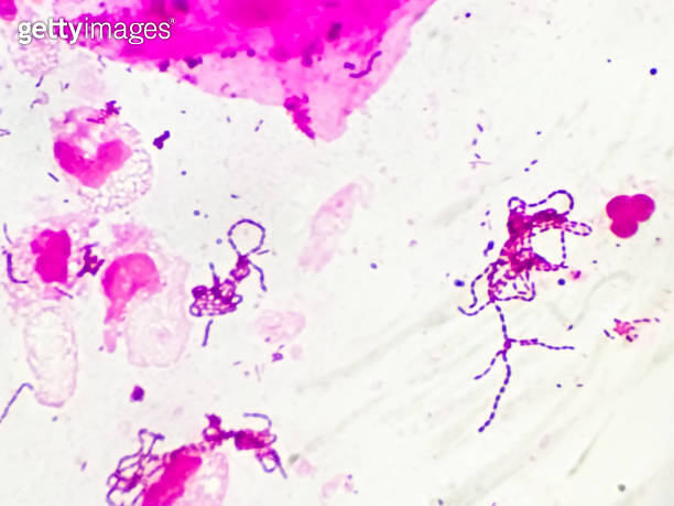 Staphylococcus pyogenes bacteria. 이미지 (1761701786) - 게티이미지뱅크