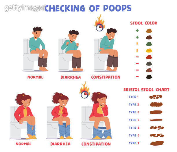 Infographic Illustrates Various Stool Forms In A Child, Ranging From ...