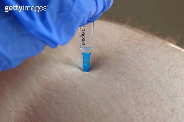 Needle injecting into the muscle. Nurse doing a trigger point injection ...