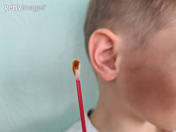Earwax in child dirty ear and cotton swab 이미지 (1456113061) - 게티이미지뱅크