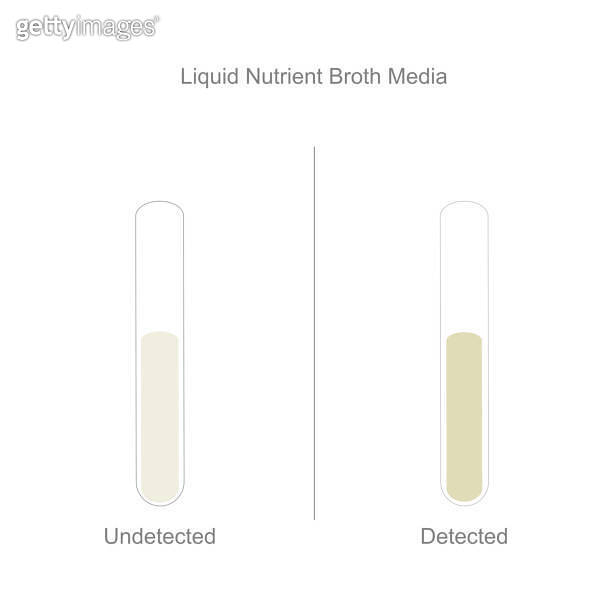The bacteria culture in Liquid Nutrient Broth Media that shows the ...