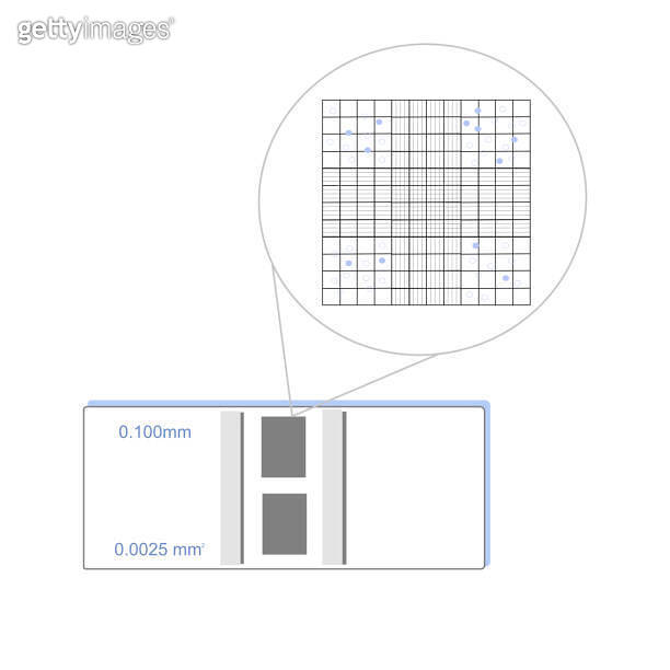 The picture shows the target cells on grid line of hemocytometer or the ...