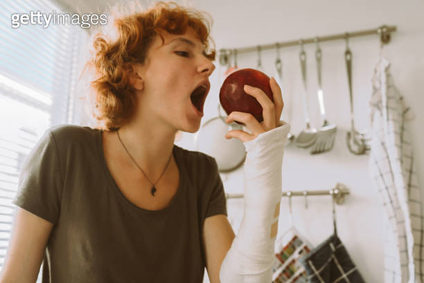 teenage girl with broken arm in cast in kitchen sitting on countertop ...