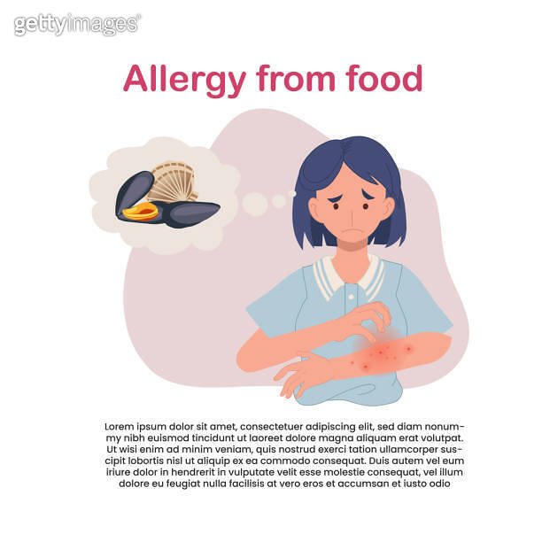 seafood Allergy Reaction. Woman with Itchy Red Rash on Arm. Allergic ...