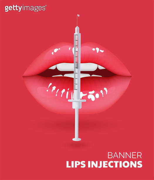 3D illustration of realistic lips undergoing a cosmetic procedure for ...