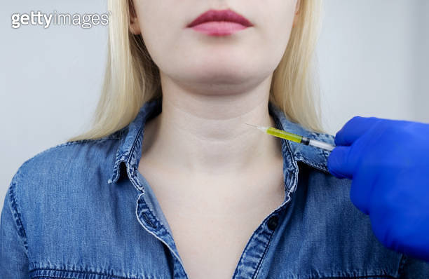 Venus rings. Skin folds on the neck due to loss of elasticity. Removal ...