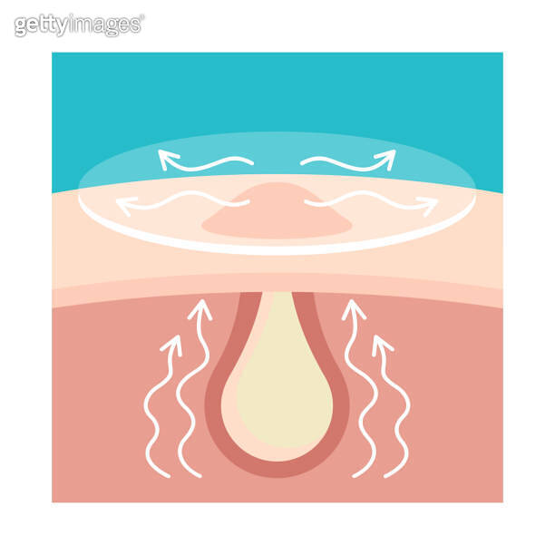 Acne pimple patch square illustration (1497134704) 일러스트, 무료 일러스트, 아이콘 ...