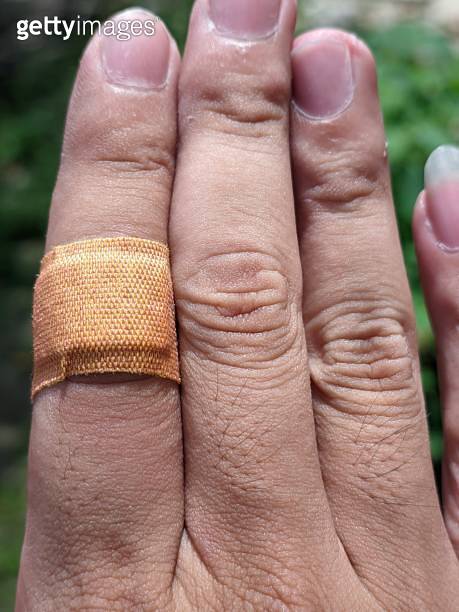 close up photo of an injured finger wrapped in plaster (1570610320 ...