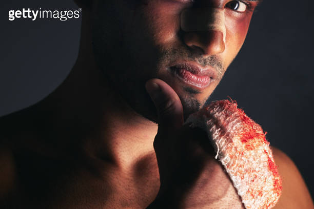 Fight, blood and portrait of man with bruise on eye, face and bloody ...