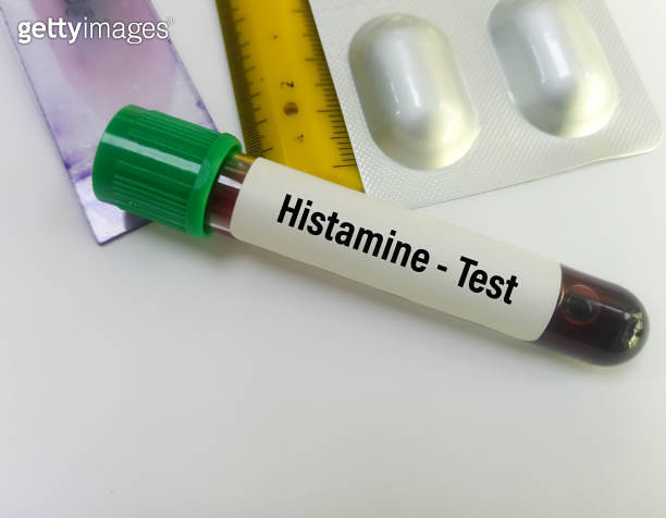 Blood sample for Histamine blood test, to diagnosis of anaphylaxis ...