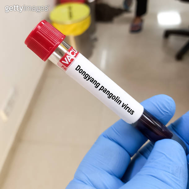 Blood Sample for dongyang pangolin virus test. (1743907194) - 게티이미지뱅크