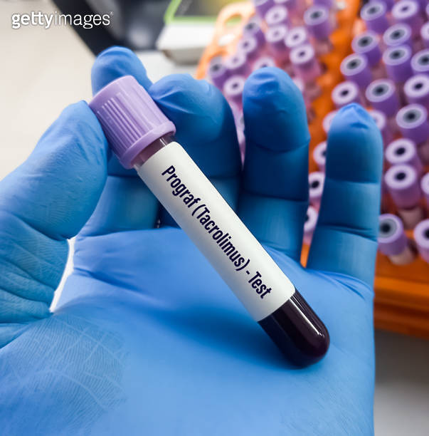 Blood sample for Prograf (Tacrolimus) level test, immunosuppressive ...