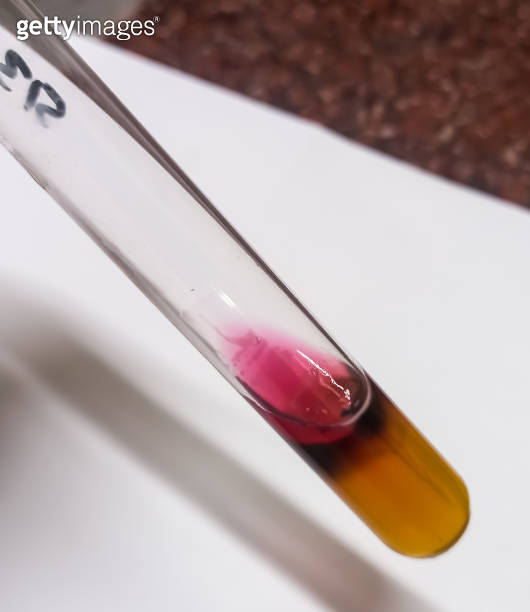 Triple Sugar Iron (TSI) Agar for the detection bacteria in microbiology ...