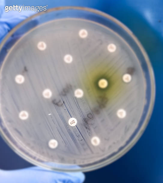 Antimicrobial susceptibility testing in culture plate. Drug sensitivity ...